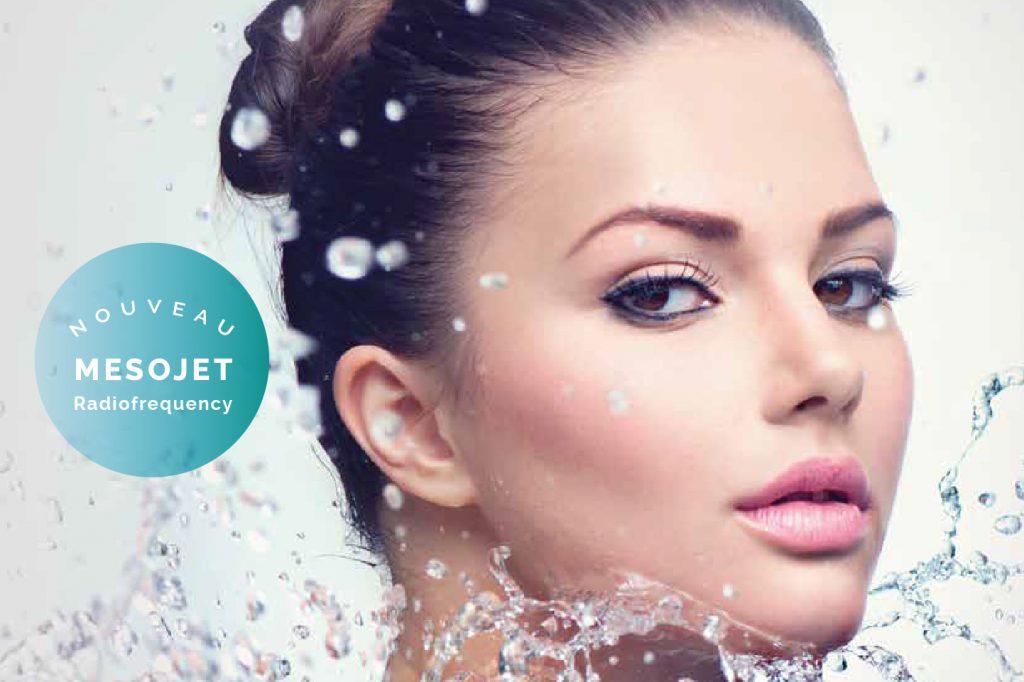 Remontez le temps grâce au concept unique de la Mesojet technology ...