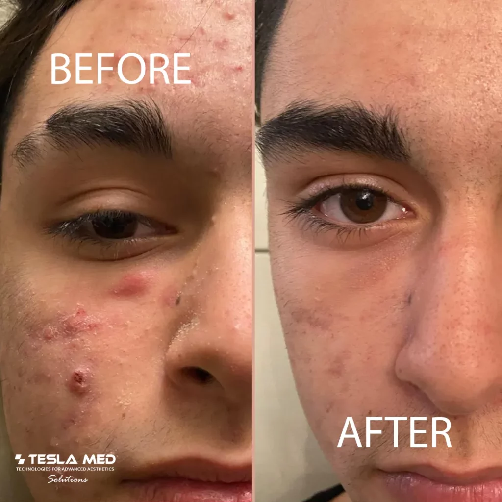 Tesla Med - Institut Myskin