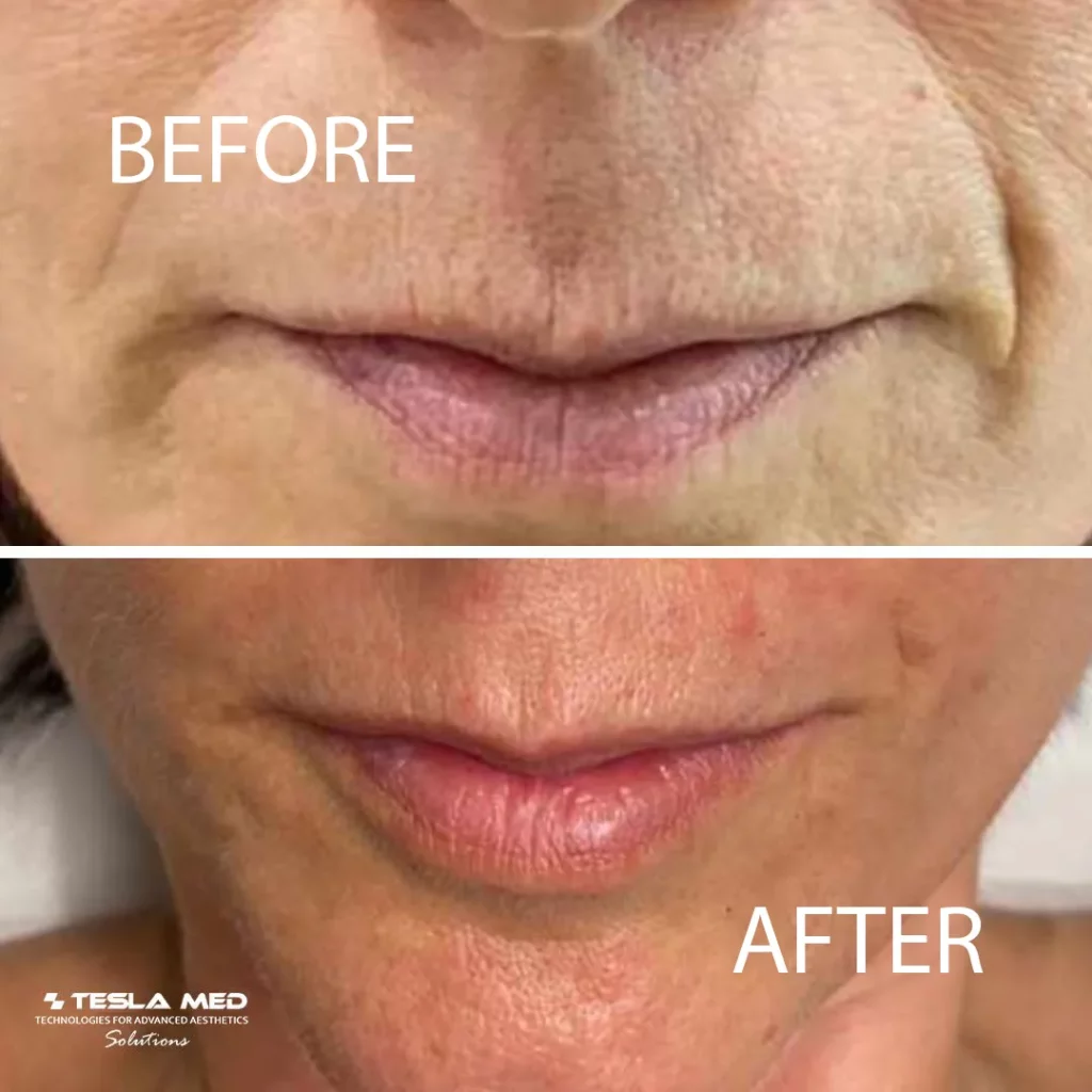 Tesla Med - Institut Myskin